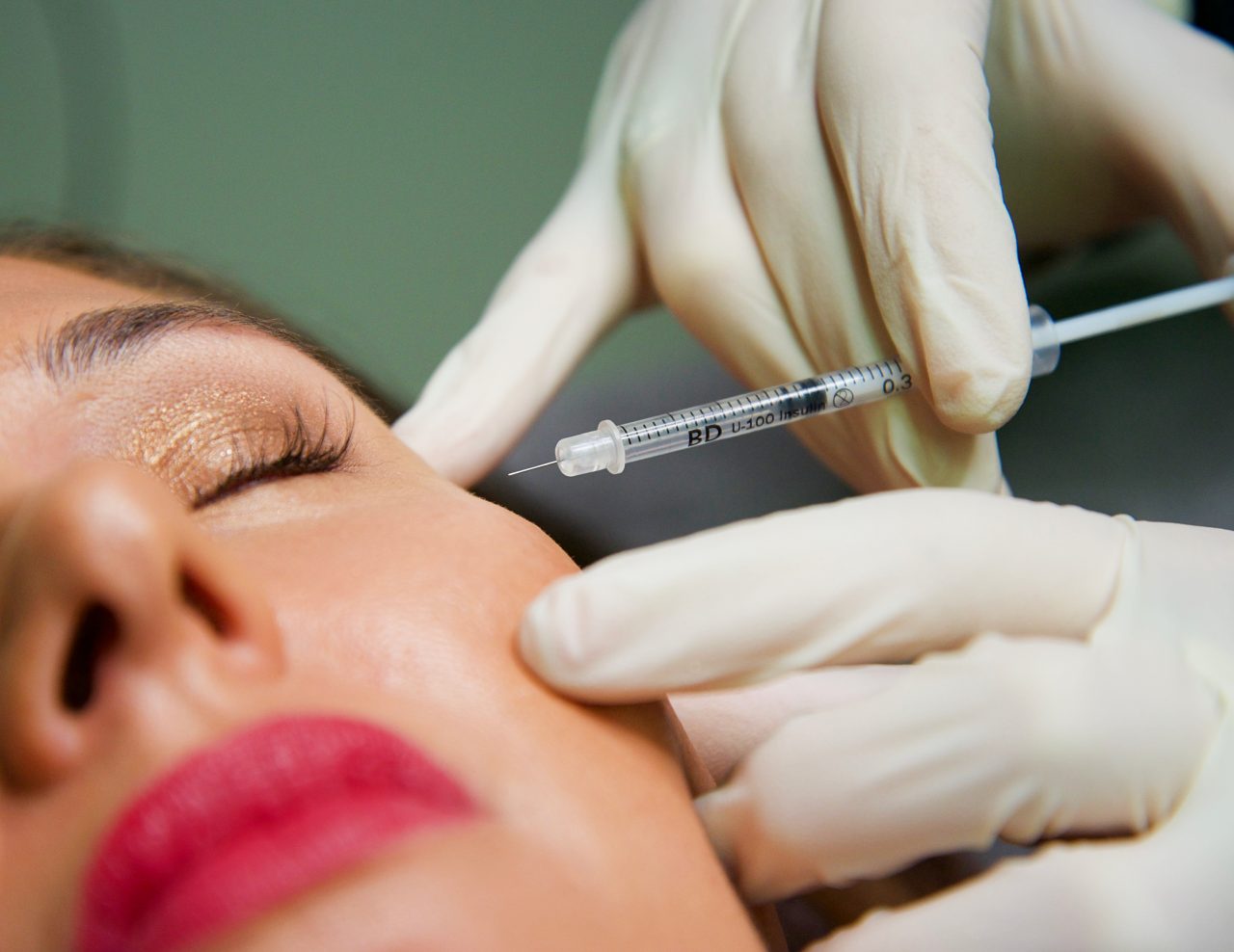 Filler - Allure Skin & Laser - Waikanae